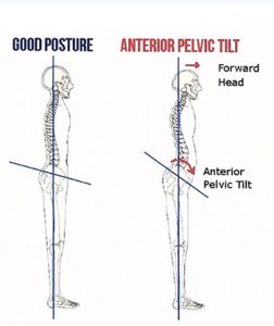 Pay Attention To Your Psoas - Unlock Your Body Fit